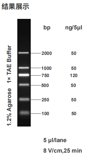 DL2000 DNA Marker